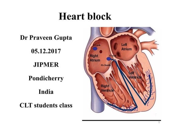 Heart Block with Nursing Management | PDF | Heart and Cardiovascular ...