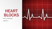 Heart block | PPT