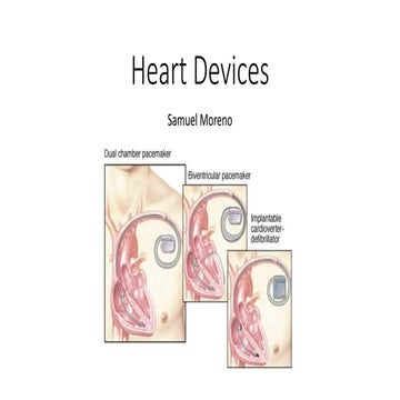 Heart devices | PPTX