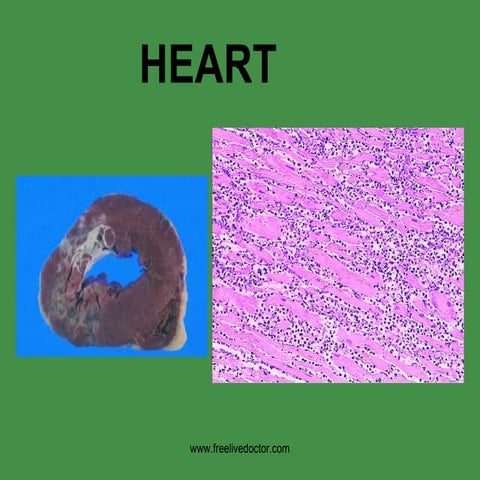 cardiac pathology usmle . High yield arrows by dr mike from Melman ...