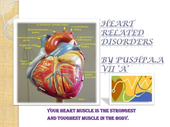 Heart failure | PPT