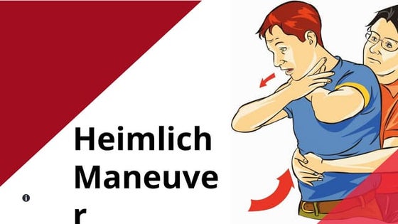 Heimlich_Maneuver_First Aid Presentation.pptx