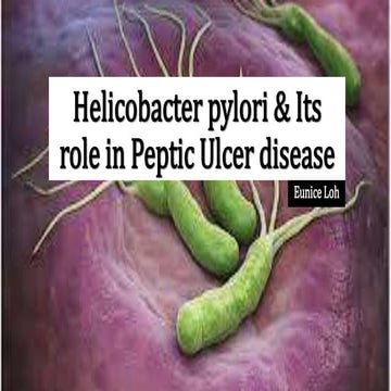 Helicobacter pylori & Its role in Peptic Ulcer.pptx