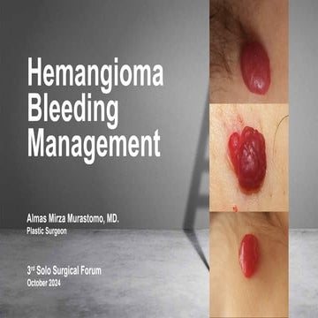 Hemangioma Bleeding Management - Almas - SSF 2024.pptx