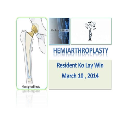 HEMIARTHROPLASTY.pptx
