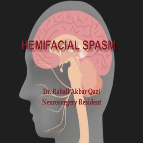 Hemifacial spasm | PPTX
