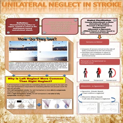 Hemispatial neglect syazwan | PDF