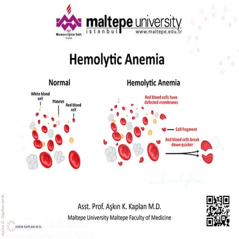 Hemolytic anemia akk | PDF