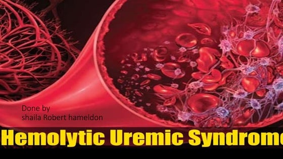 HEMOLYTIC UREMIC SYNDROME. pptx | PPTX