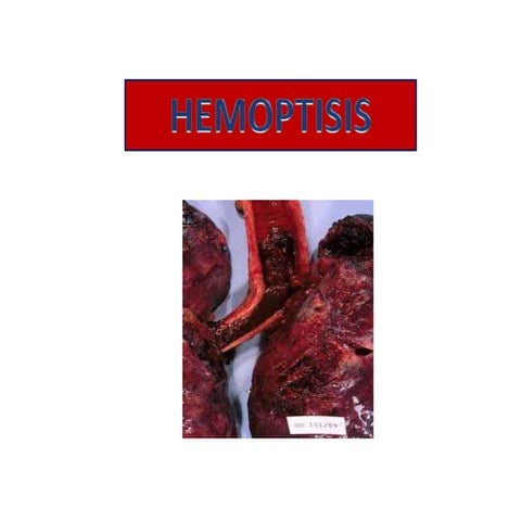 Hemoptisis | PPT