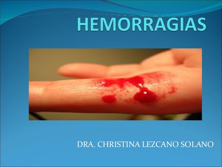 Hemorragias