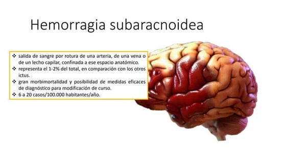 accidente cerebrovascular isquemico - presentacion | PPT