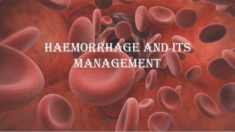 Hemorrhage and its Management