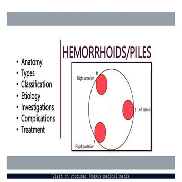 HEMORRHOIDS- anatomy, pathophysiology, clinical features, diagnosis and ...