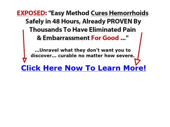Hemorrhoids pdf | PDF
