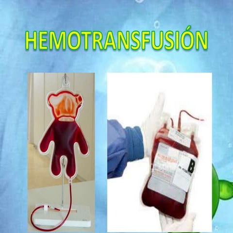 HEMOTRANSFUSIÓN | PPTX