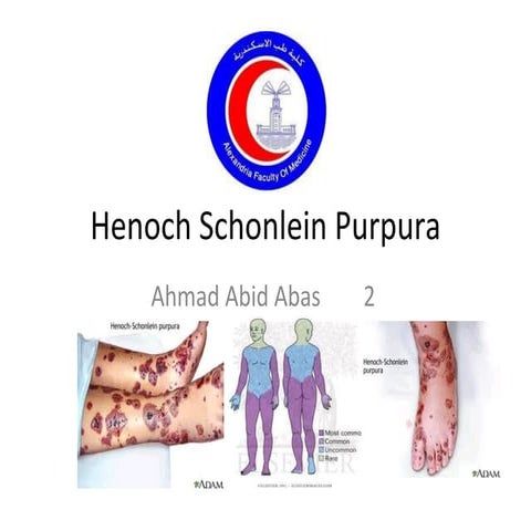 Henoch Schonlein Purpura Arthritis