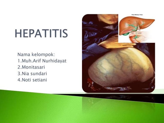 Power Point Hepatitis | PPT