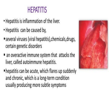 HEPATITIS PPT.pptx WITH GOOD EXPLANATION OF CHRONIC AS WELL AS ACUTE ...