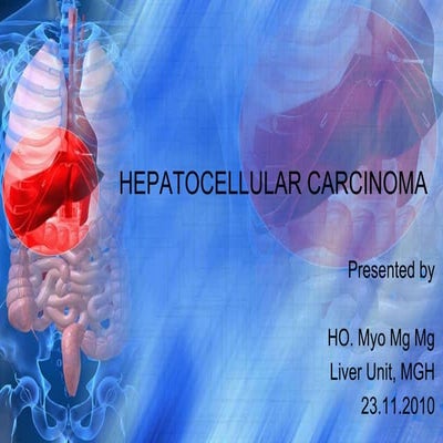 Hepatocellular carcinoma | PPTX
