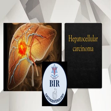 Hepatocellular carcinoma: From diagnosis to emerging therapeutics | PPTX