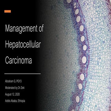 Hepatocellular carcinoma 2020 | PPTX
