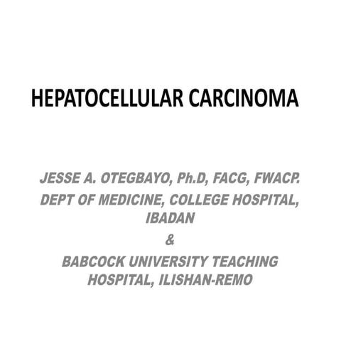 Hepatocellular carcinoma | PPTX
