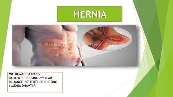 Get to Know the Advanced Method of Hernia | PPTX | Digestive Disorders | Diseases and Conditions