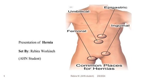 Nursing care of patients with Hernia | PPTX | Digestive Disorders | Diseases and Conditions