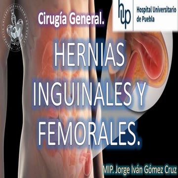 Hernias inguinales y femorales. | PPTX