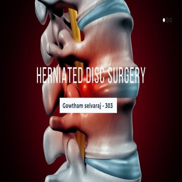 Herniated Disc Surgery( Gowtham 303).pdf