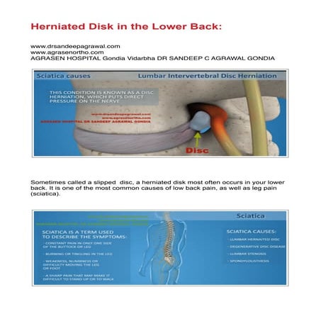 Mechanical stability of lumber spine (1).pptx