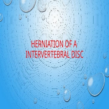 Intervertebral disc prolapse(ivdp) | PPTX
