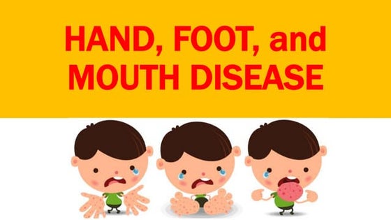 Hand foot-mouth disease (hfmd) | PDF | Infectious Diseases | Diseases ...