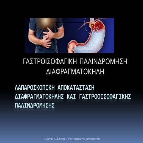 Παλινδρόμηση - Διαφραγματοκήλη | PDF