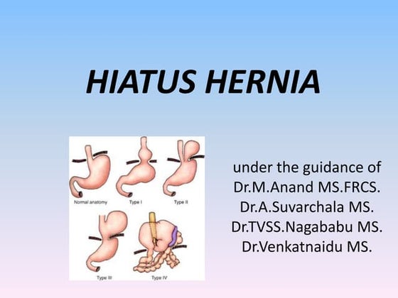 Hernia hiatus | PPTX | Digestive Disorders | Diseases and Conditions