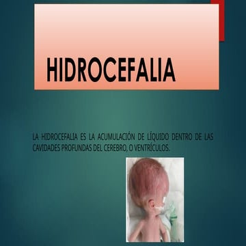 HIDROCEFALIA, MICROCEFALIA, RCP NEONATAL.pptx