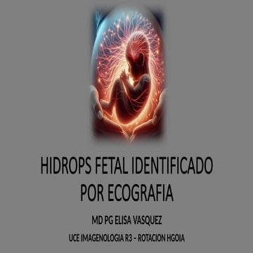 hidrops_fetal ginecología y obstetricia . | PPTX