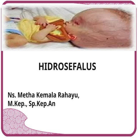 Hidrosefalus dan teori serta askepnya.pptx