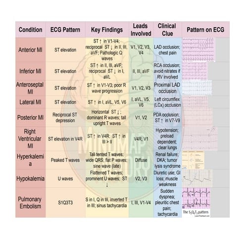 Comprehensive ECG Patterns and Clinical Correlations for Cardiac ...