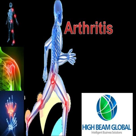 Arthritis | PPT