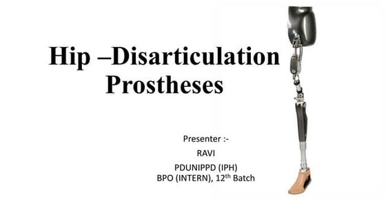 Biomechanics of Quadrilateral socket | PPTX