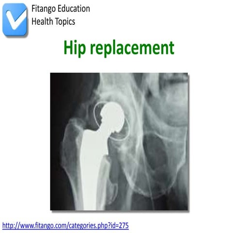 Total hip replacement | PPSX