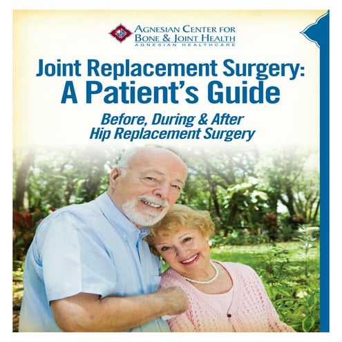 A Patient's Guide to Hip Replacement Surgery: Ripon Medical Center | PDF
