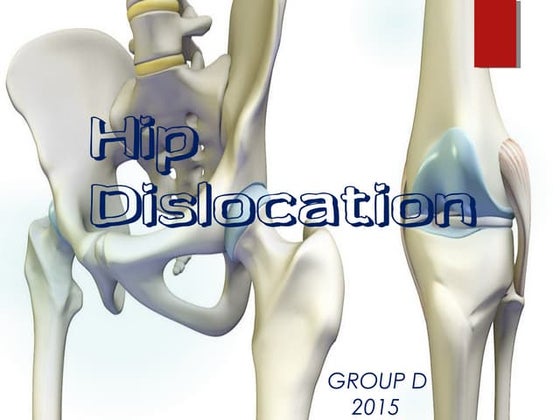 Hip Reduction Techniques | PPT