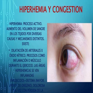 HIPERHEMIA. Proceso activo aumento de volumen | PPTX