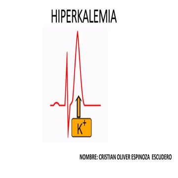 Hiperkalemia | PPT