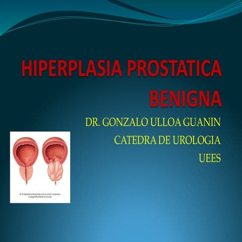 Hiperplasia Prostática Benigna Urologia. | PDF