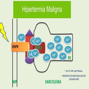 hipertermia maligna.pptx