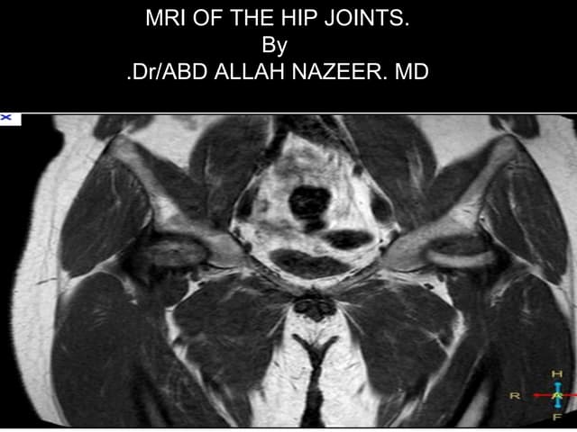 HIP X-RAY.pptx